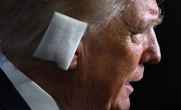 Con una venda en la oreja, Trump dio su primer discurso público tras el ...
