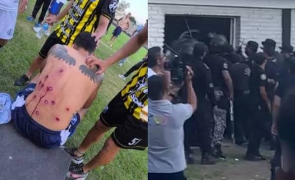 Otro día de furia en el Regional Amateur: represión y balas de goma en ...